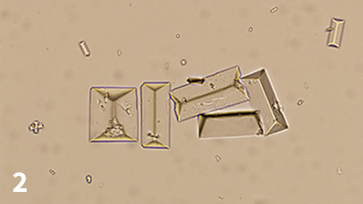 Urinalysis Interpretation | Clinician's Brief