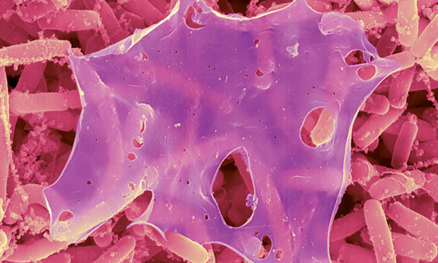 Biofilms & Urinary Tract Infections…A Sticky Situation