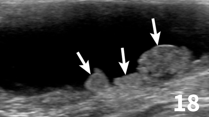 Imaging the Urinary Tract | Clinician's Brief