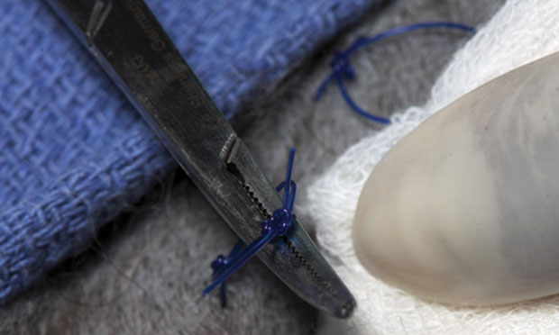 Wound Management: Tie-Over Bandages | Clinician's Brief