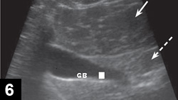 Feline Infectious Peritonitis [2014] | Clinician's Brief
