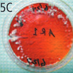Fungal Cultures for Diagnosing Dermatophytosis | Clinician's Brief