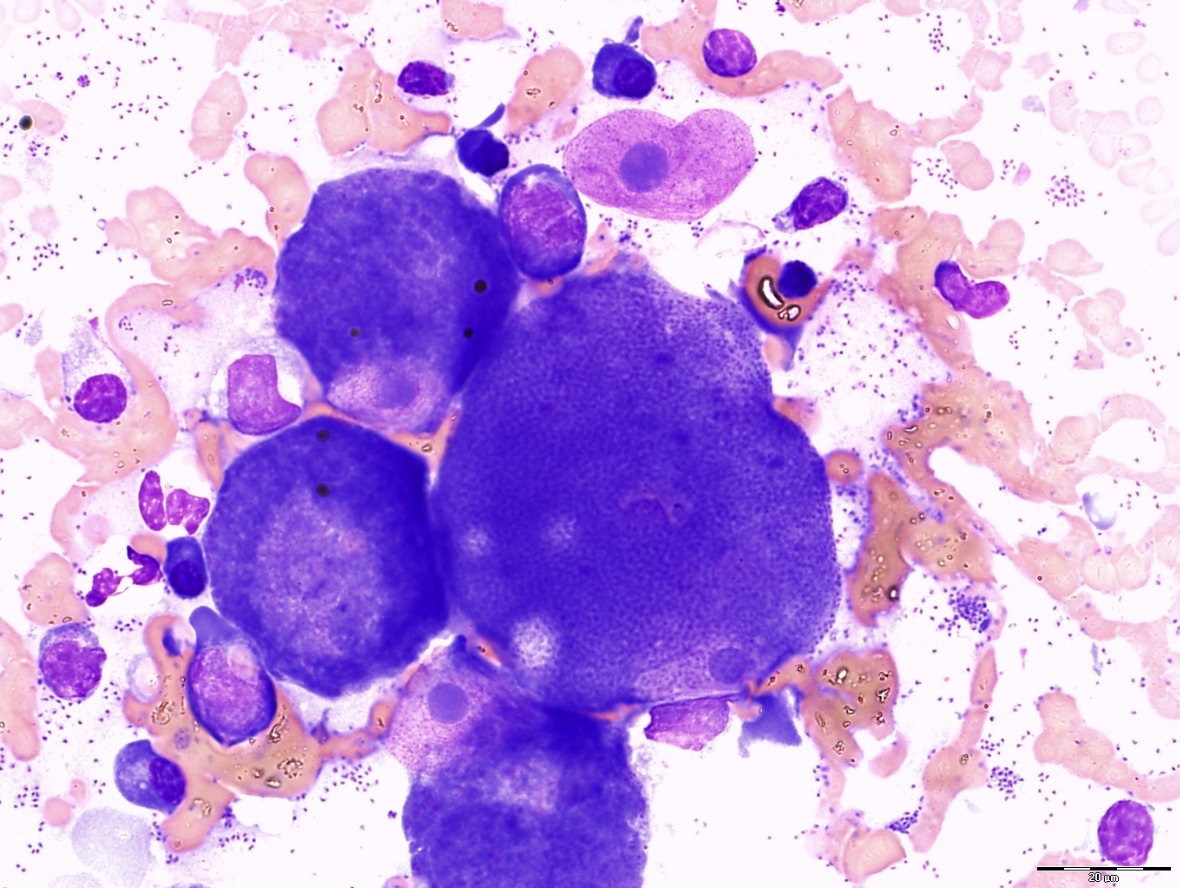 Clinical Image: Splenic Aspirate Image