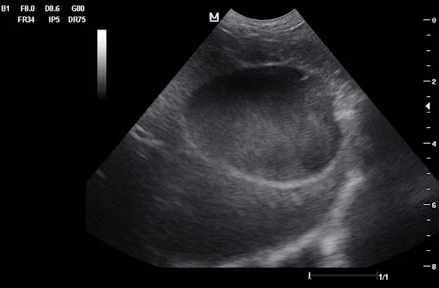 Diagnosis, Treatment, & Prognosis of Prostatitis in Dogs