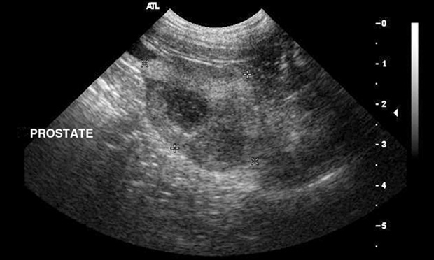 Prostatic Disease in Dogs: Profile, Diagnosis, Treatment