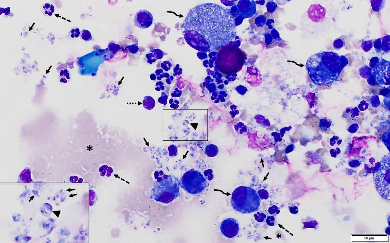 Clinical Image: What Are the Small Solid Arrows Pointing To?