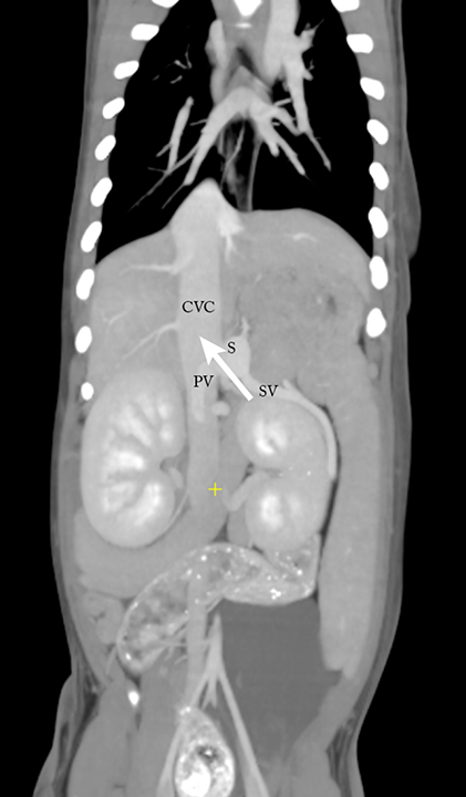 Congenital Portosystemic Shunt in a Dog | Clinician's Brief