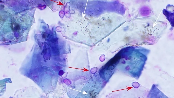 Clinical Image: Canine Ear Cytology