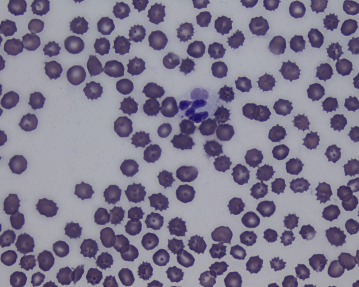 Clinical Image: Blood Smear