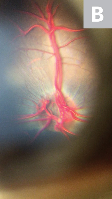 Smartphone Technology in Clinical Ophthalmology | Clinician's Brief