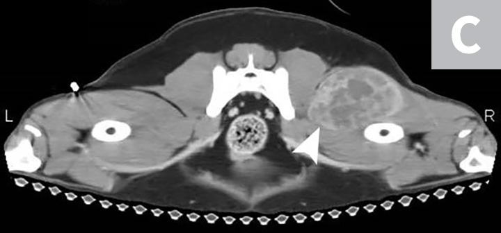 Canine Hemangiosarcoma | Clinician's Brief