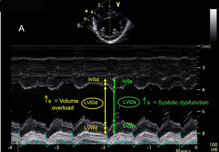 Echocardiography in General Practice: 4 Views to Master | Clinician's Brief