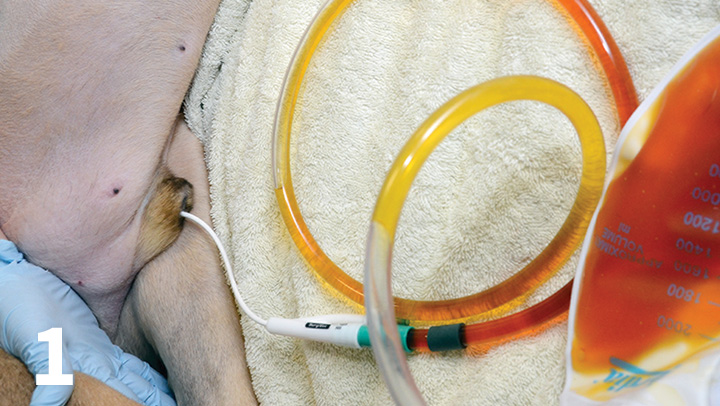 Urinary Catheters & Infection | Clinician's Brief