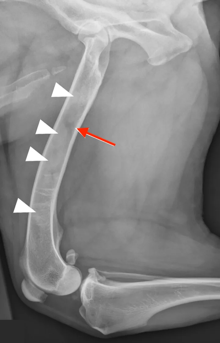 Clinical Image: Radiolucency