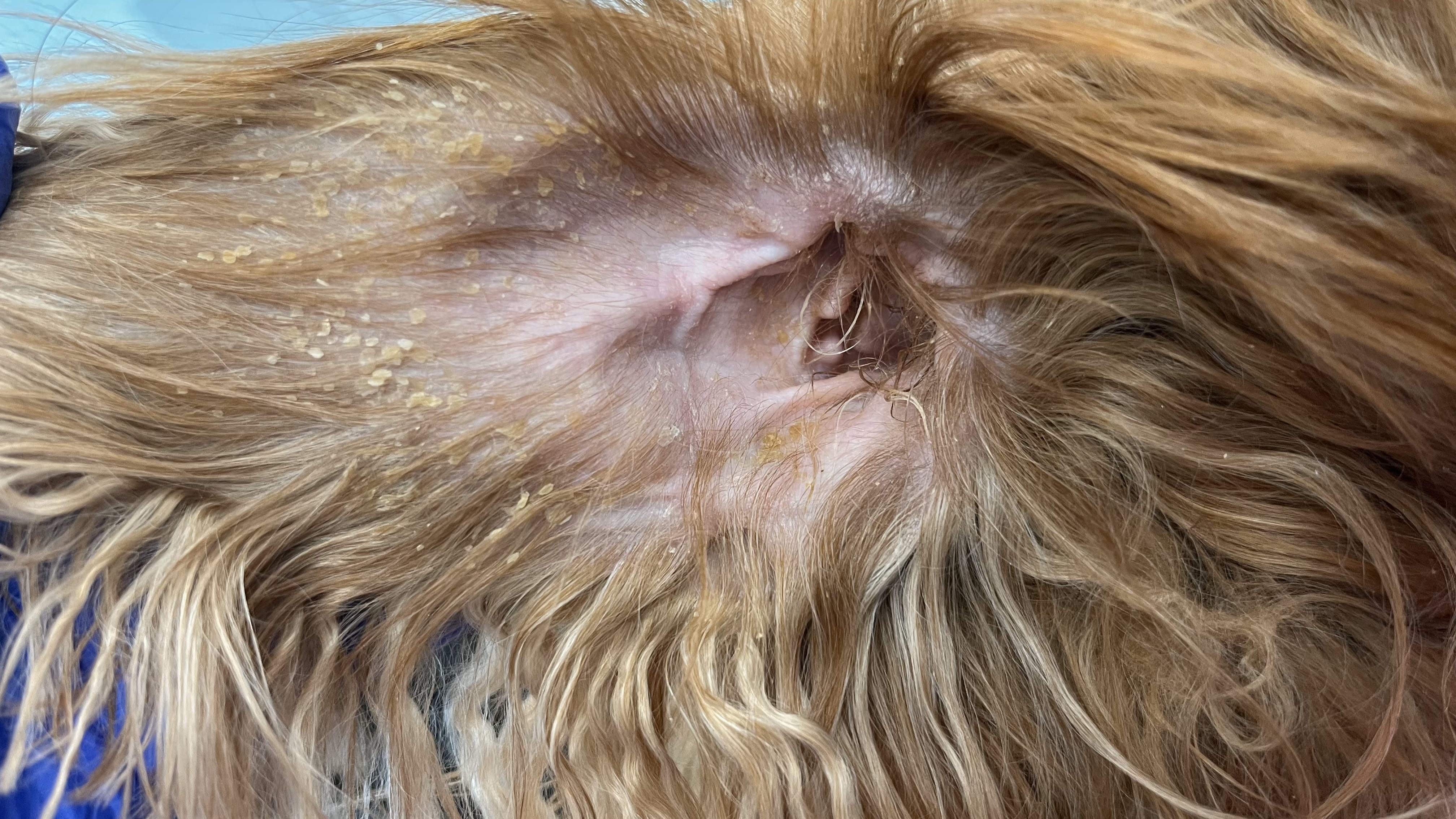 Image Quiz: Treatment Options for Otitis Externa