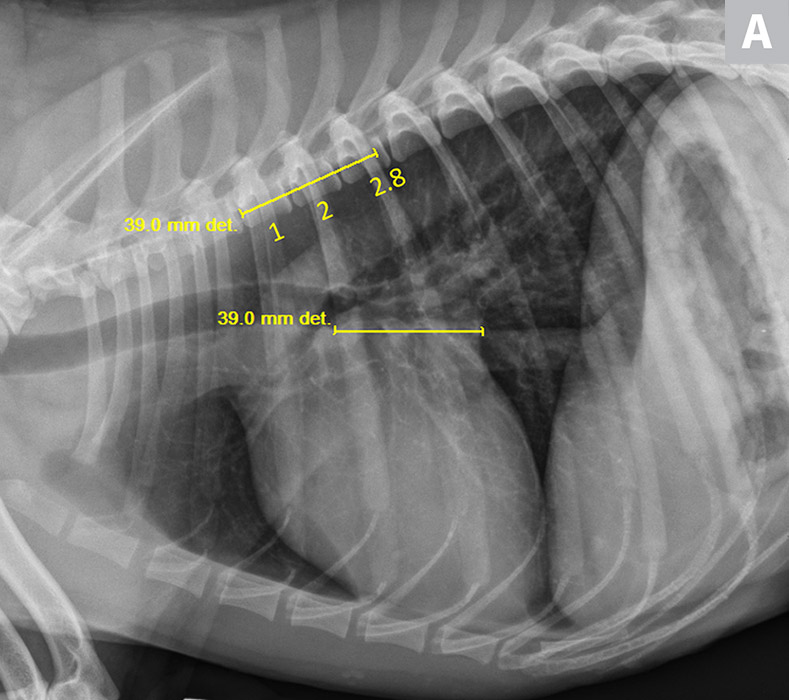 Left Atrial Enlargement X Ray