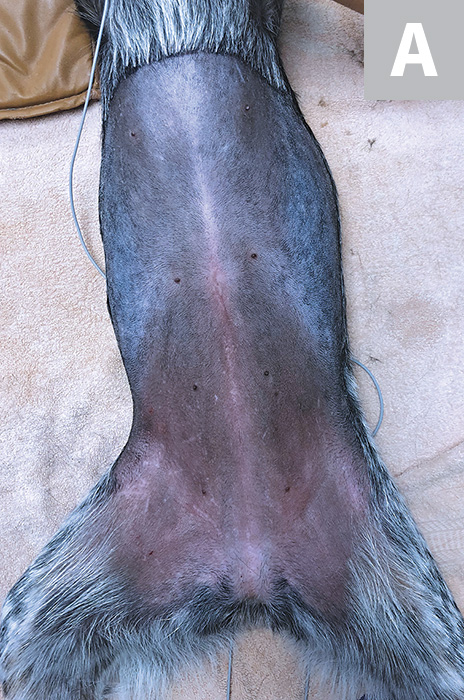 A Step-by-Step Guide to Exploratory Celiotomy | Clinician's Brief