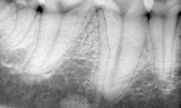 How to Interpret Dental Radiographs