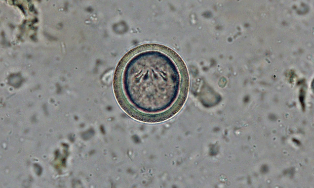 Giardia Cyst In Fecal Float