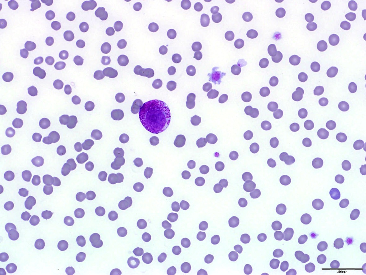 Clinical Image: Feline Blood Smear
