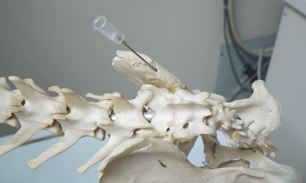 Intraosseous Catheterization: Background & How to Perform