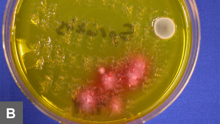 Microscopic Examination of Fungal Cultures | Clinician's Brief