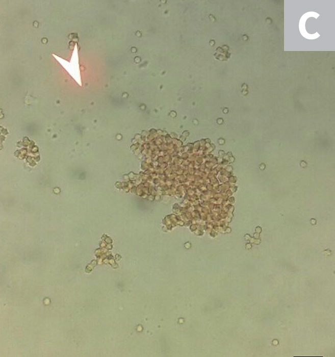 Use of Crossmatching Prior to First Transfusion in Cats | Clinician's Brief