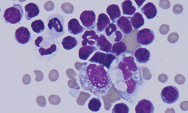 Chylous Effusion in a Cat