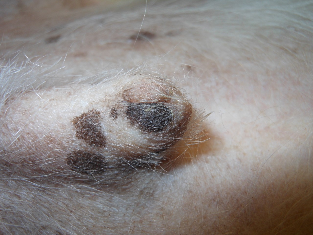 Clinical Image: Name the Pigmented Skin Lesion