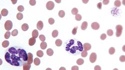 Anemia in a Cat—Can You Identify Why? | Clinician's Brief