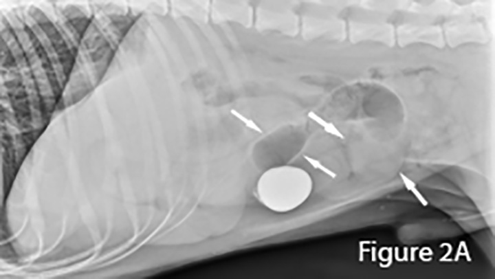 Imaging Intestinal Obstruction | Clinician's Brief
