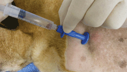 How to Collect Bone Marrow Samples | Clinician's Brief