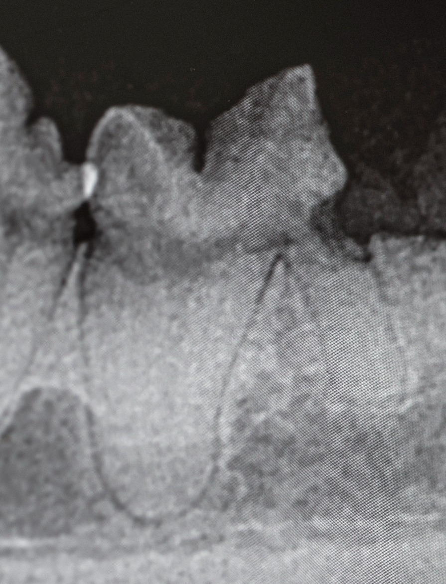 Clinical Image: What Is Affecting This Cat’s Left Mandibular Molar Tooth?
