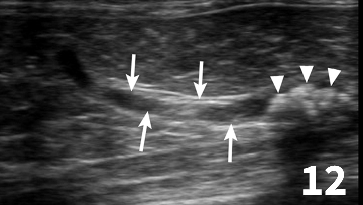 Imaging the Urinary Tract | Clinician's Brief