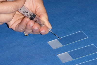 Fine-Needle Aspiration | Clinician's Brief