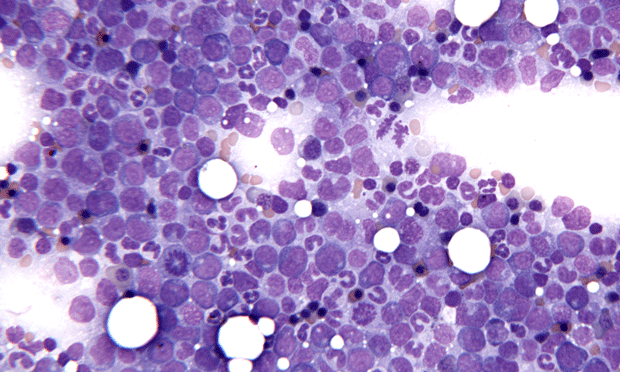 Anemia in a Cat—Can You Identify Why?