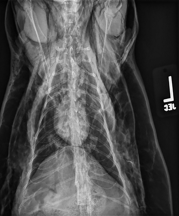 Pneumomediastinum: From Diagnosis to Prognosis | Clinician's Brief