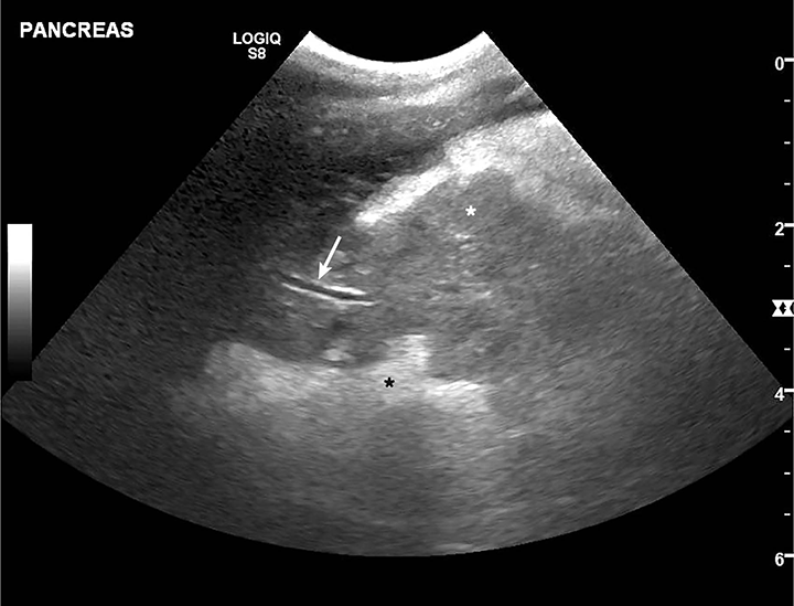 Acute Pancreatitis in Dogs | Clinician's Brief