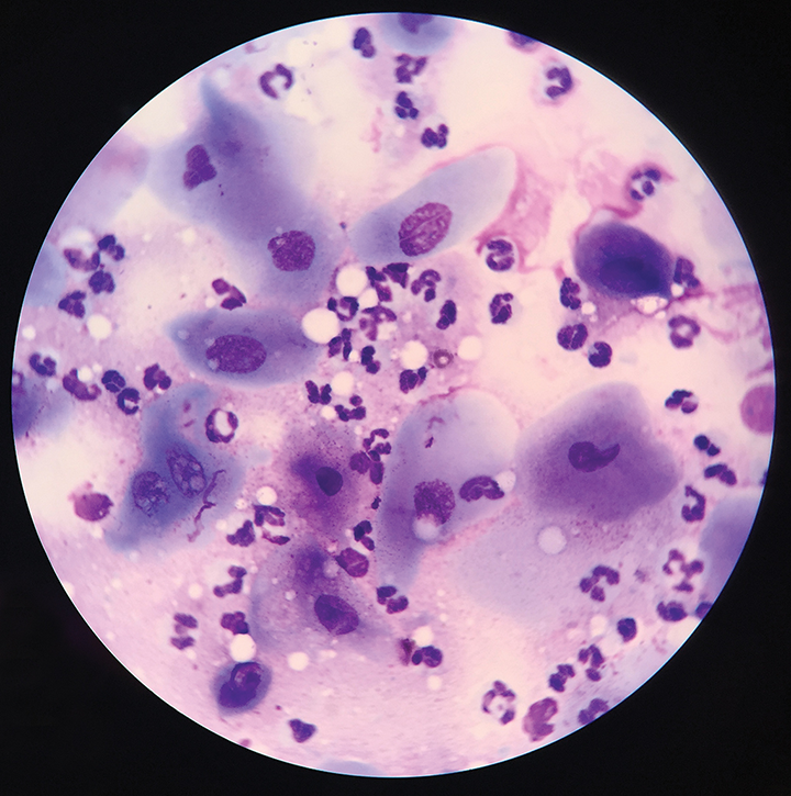 Fungal Keratitis In Dogs