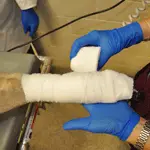 Step by Step Guide to a Closed Hip Reduction