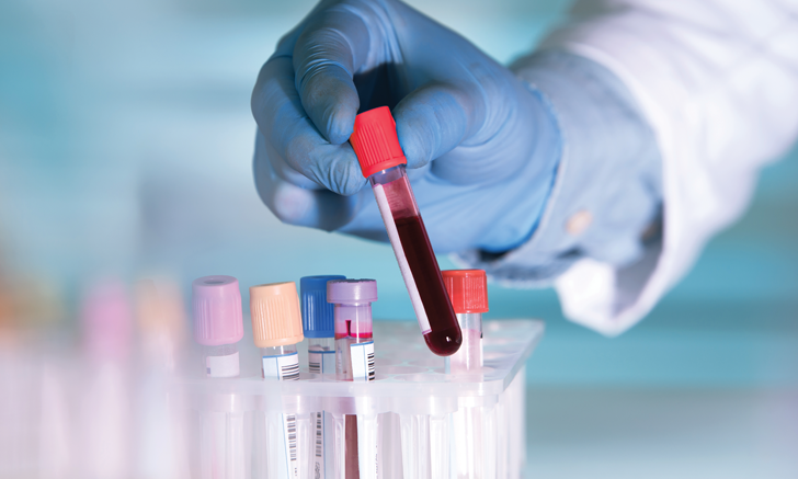 Differential Diagnosis: Hyperphosphatemia