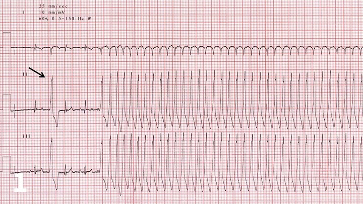 Clinical Image: Canine ECG