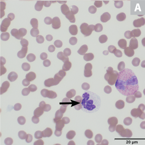 Top 5 Breed-Associated Hematologic Abnormalities | Clinician's Brief