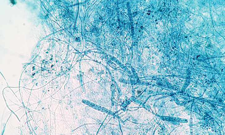 New Methods for Rapid Diagnosis of Ringworm: Study Takeaways