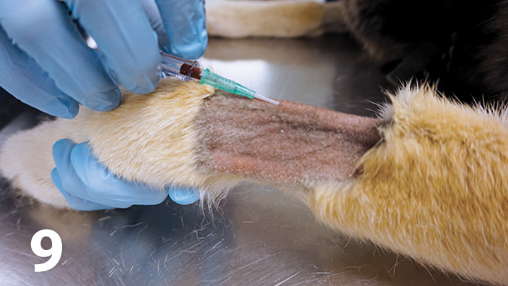 Step-by-Step: Peripheral Catheter Placement | Clinician's Brief