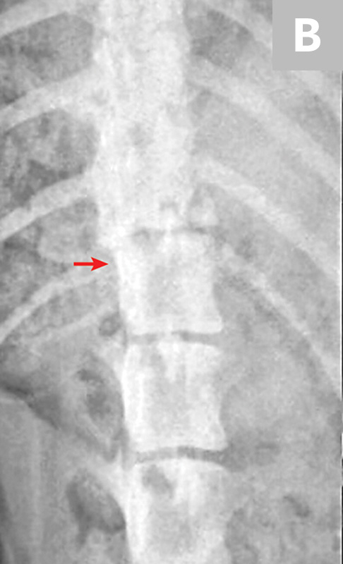 Vertebral Fractures & Luxations in Dogs & Cats | Clinician's Brief