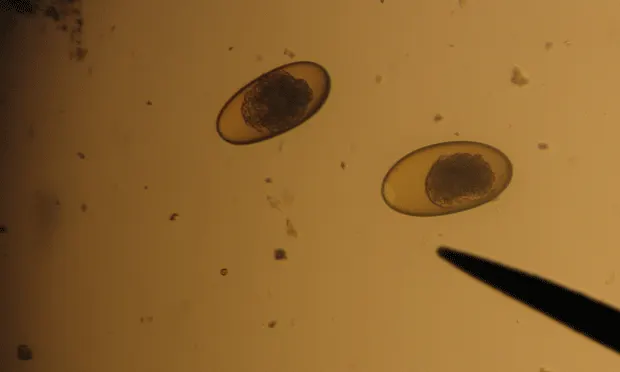 Features of Parasite Ova or Cysts
