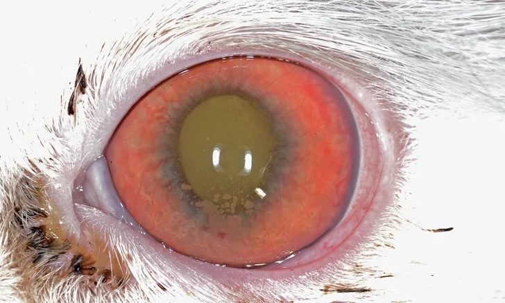 Clinical Image: Cat Eye