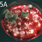 Fungal Cultures for Diagnosing Dermatophytosis | Clinician's Brief