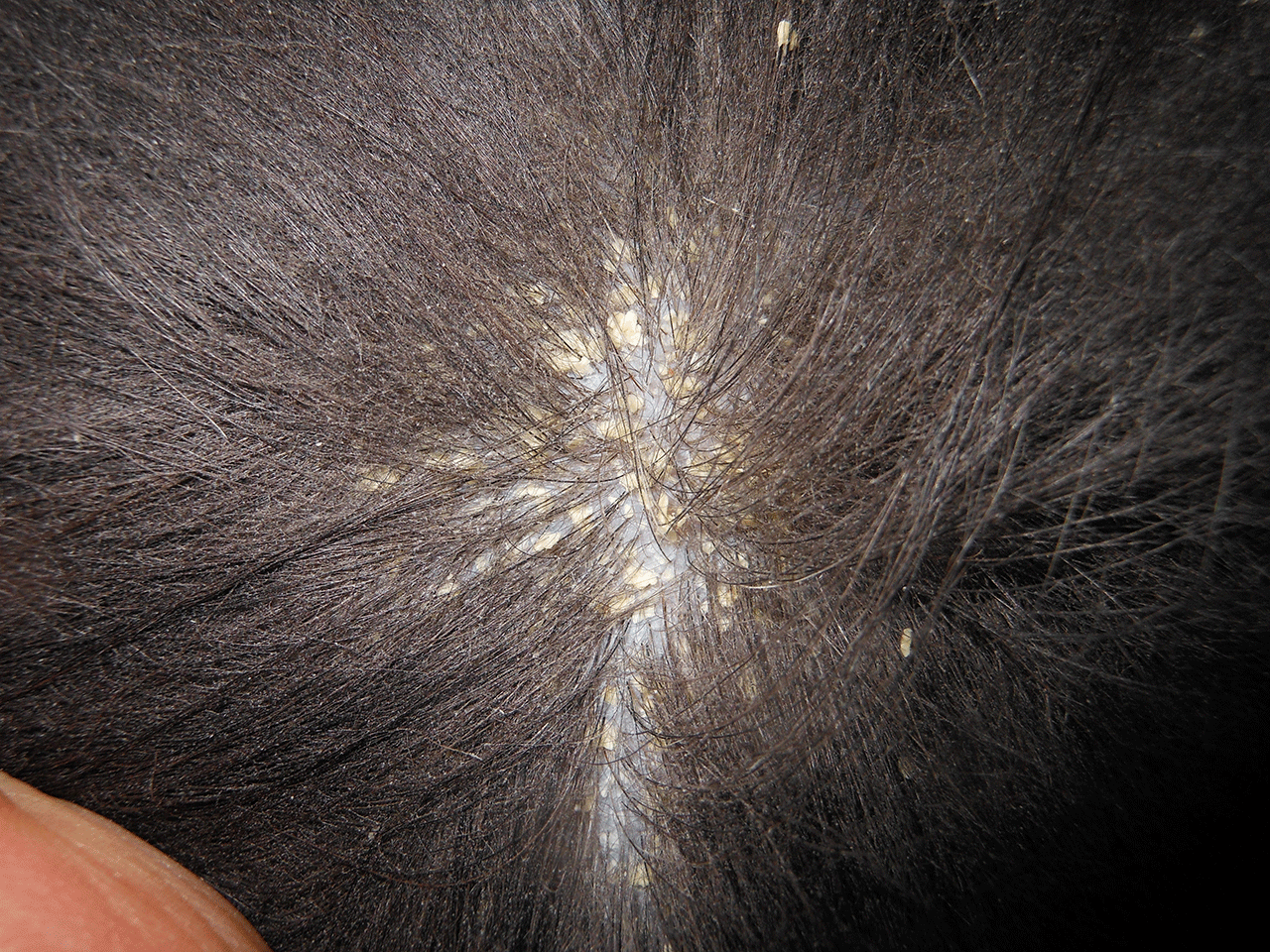 Image Gallery: Secondary Skin Lesions | Clinician's Brief